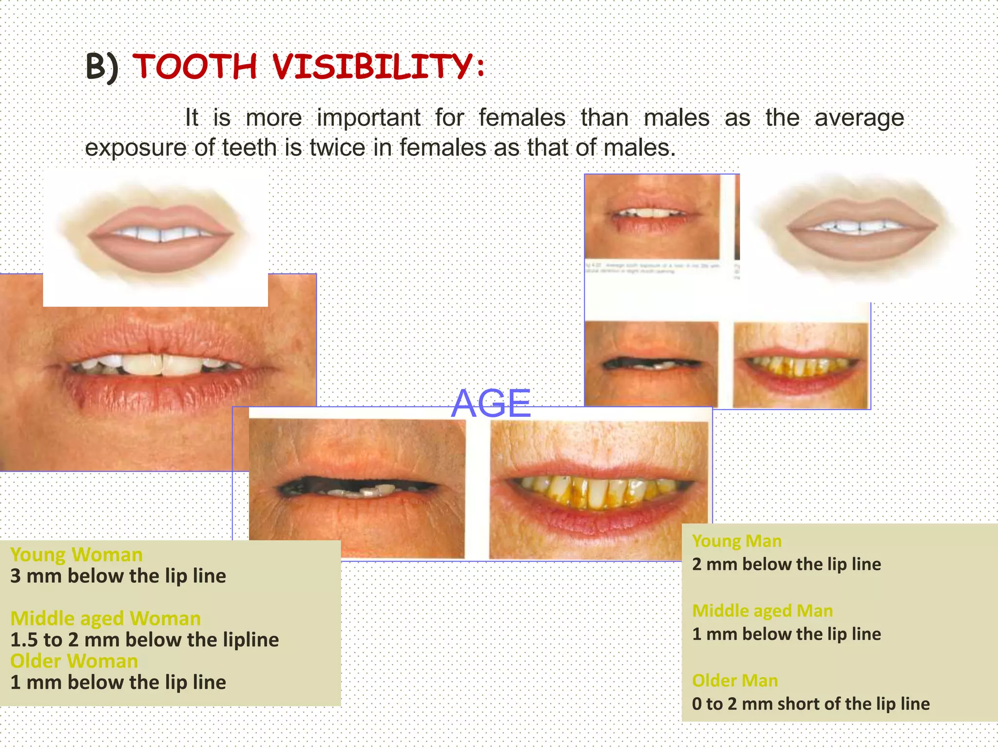 Esthetics in complete dentures dentogenic concept | PPTX