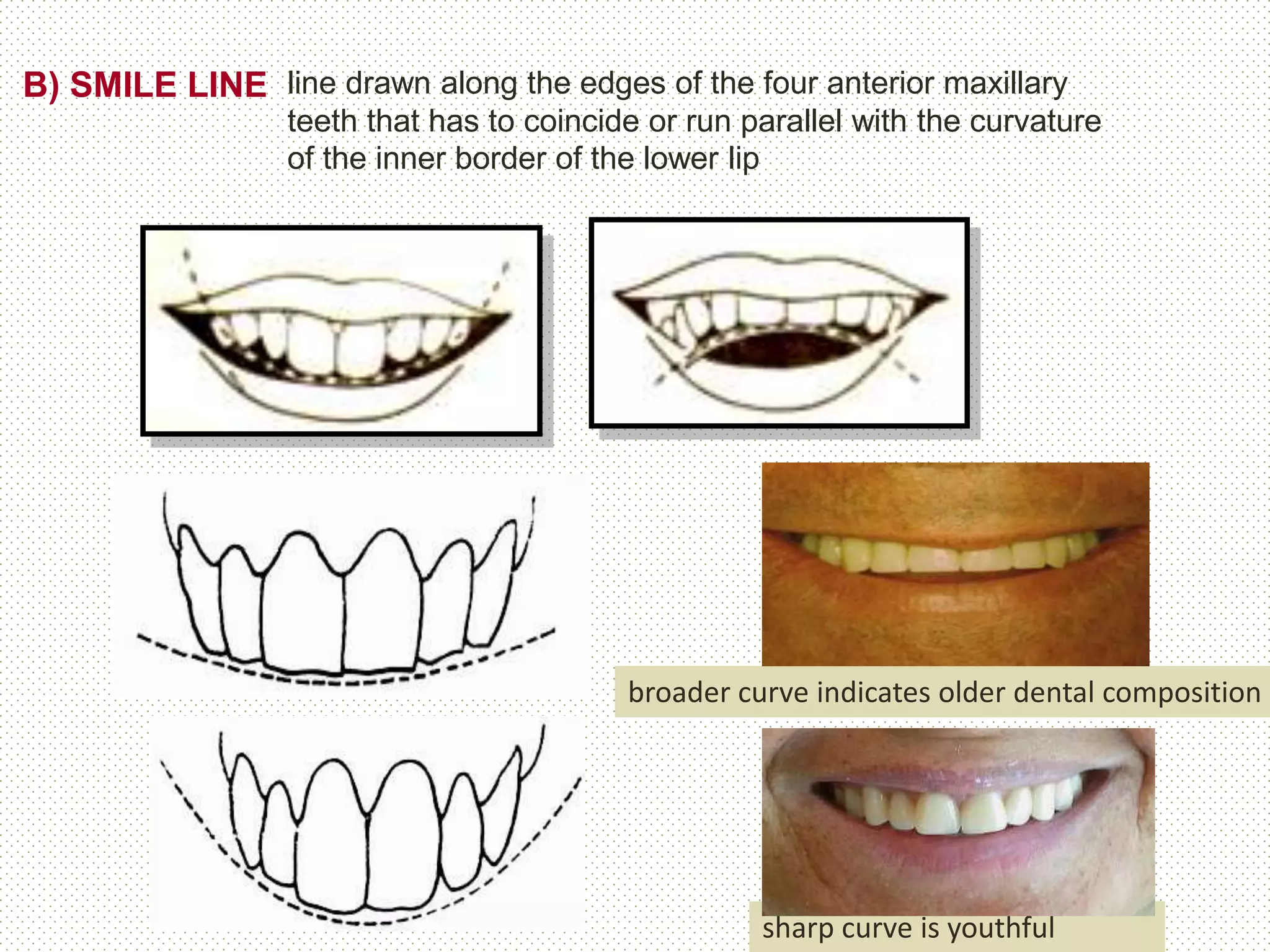 Esthetics in complete dentures dentogenic concept | PPTX