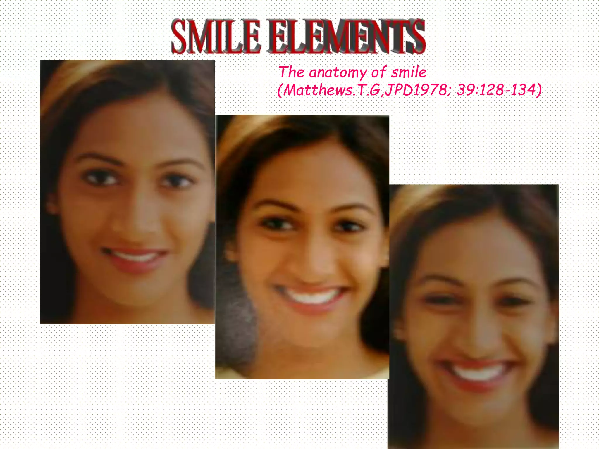 Esthetics in complete dentures dentogenic concept | PPTX