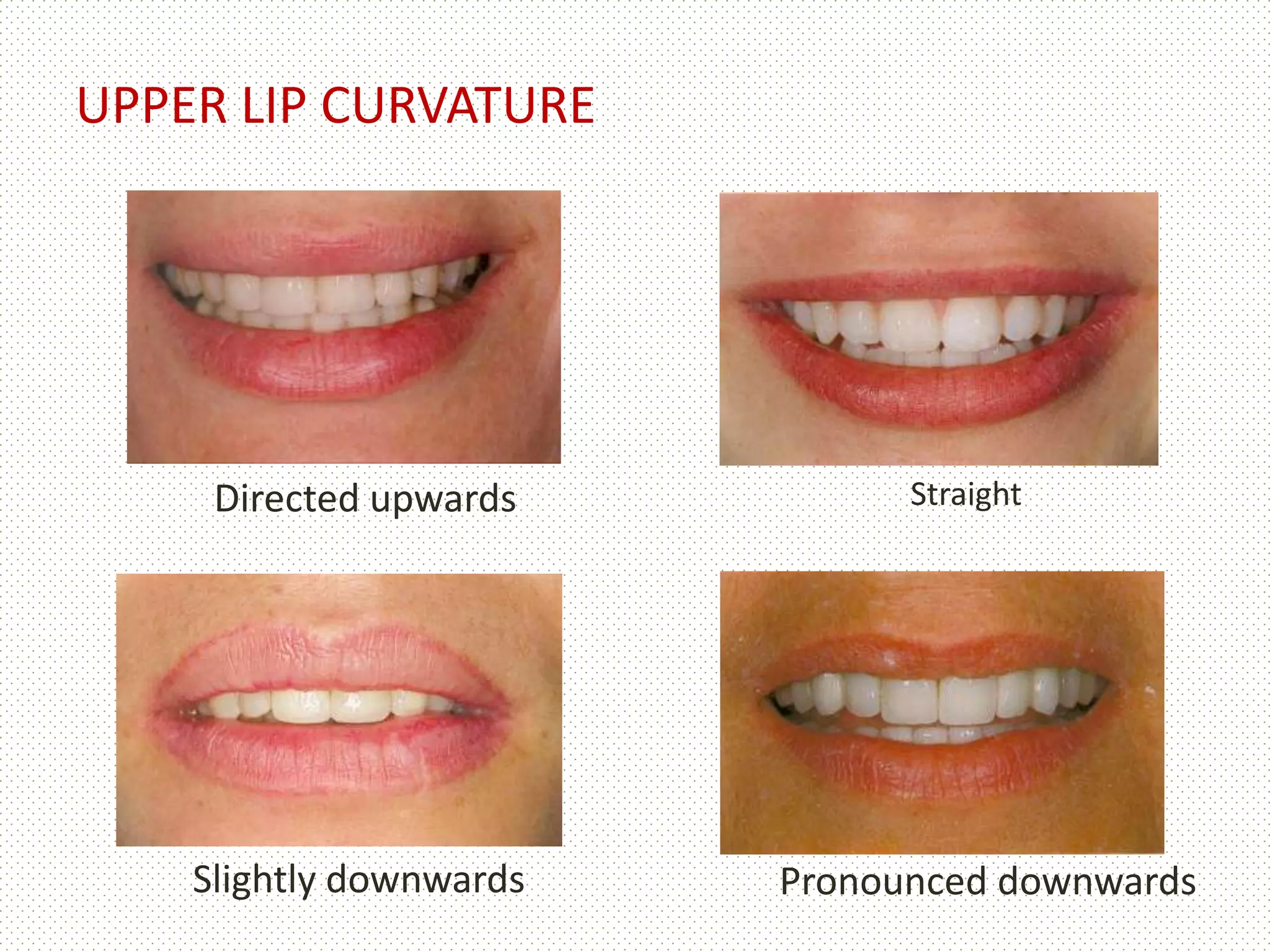 Esthetics in complete dentures dentogenic concept | PPTX | Dental ...
