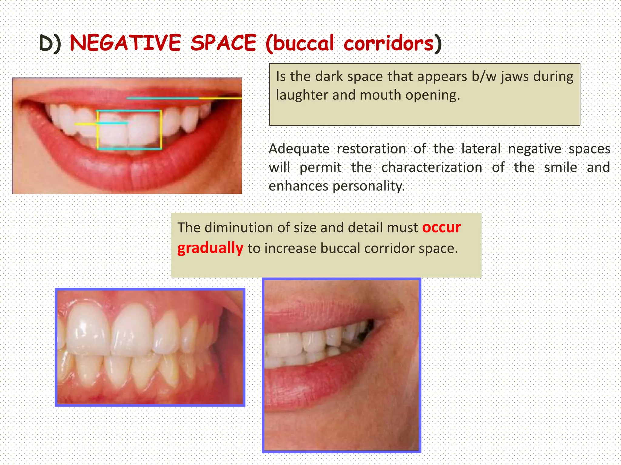 Esthetics in complete dentures dentogenic concept | PPTX