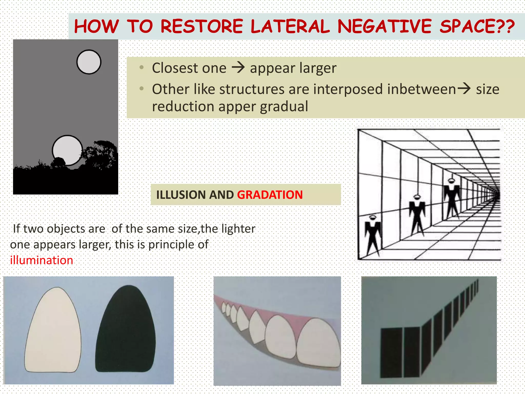 Esthetics in complete dentures dentogenic concept | PPTX