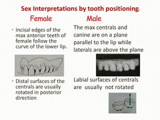 Esthetics in complete dentures dentogenic concept | PPTX