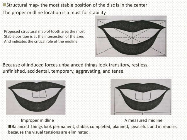 Esthetics in complete dentures dentogenic concept | PPTX | Dental ...