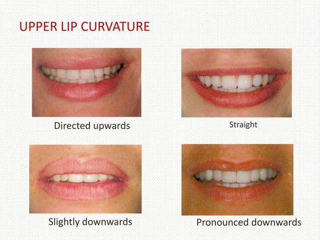 Esthetics in complete dentures dentogenic concept | PPTX | Dental ...