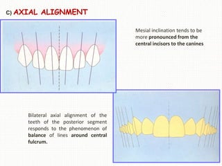 Esthetics in complete dentures dentogenic concept | PPTX