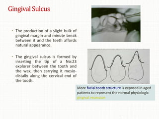 Esthetics in complete dentures dentogenic concept | PPTX