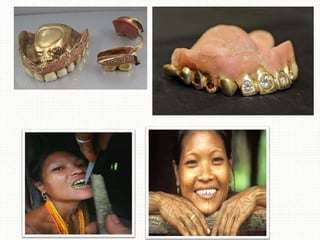 Esthetics in complete dentures dentogenic concept | PPTX