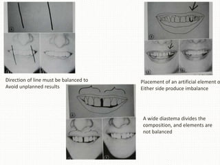 Esthetics in complete dentures dentogenic concept | PPTX