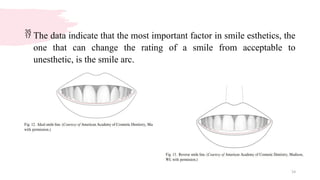 Esthetics in dentistry and smile analysis..pptx