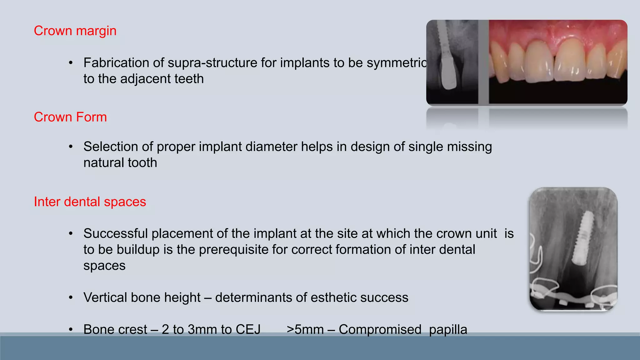 Esthetics in Implant Dentistry | PPTX