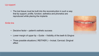Esthetics in Implant Dentistry | PPTX