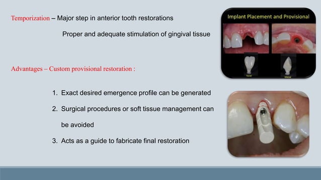 Esthetics in Implant Dentistry | PPTX