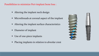 Esthetics in Implant Dentistry | PPTX