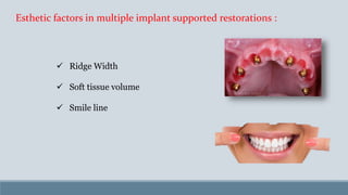 Esthetics in Implant Dentistry | PPTX