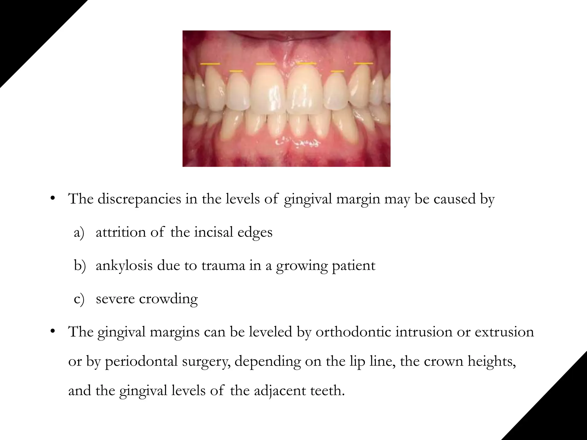 Esthetics in orthodontics | PPTX