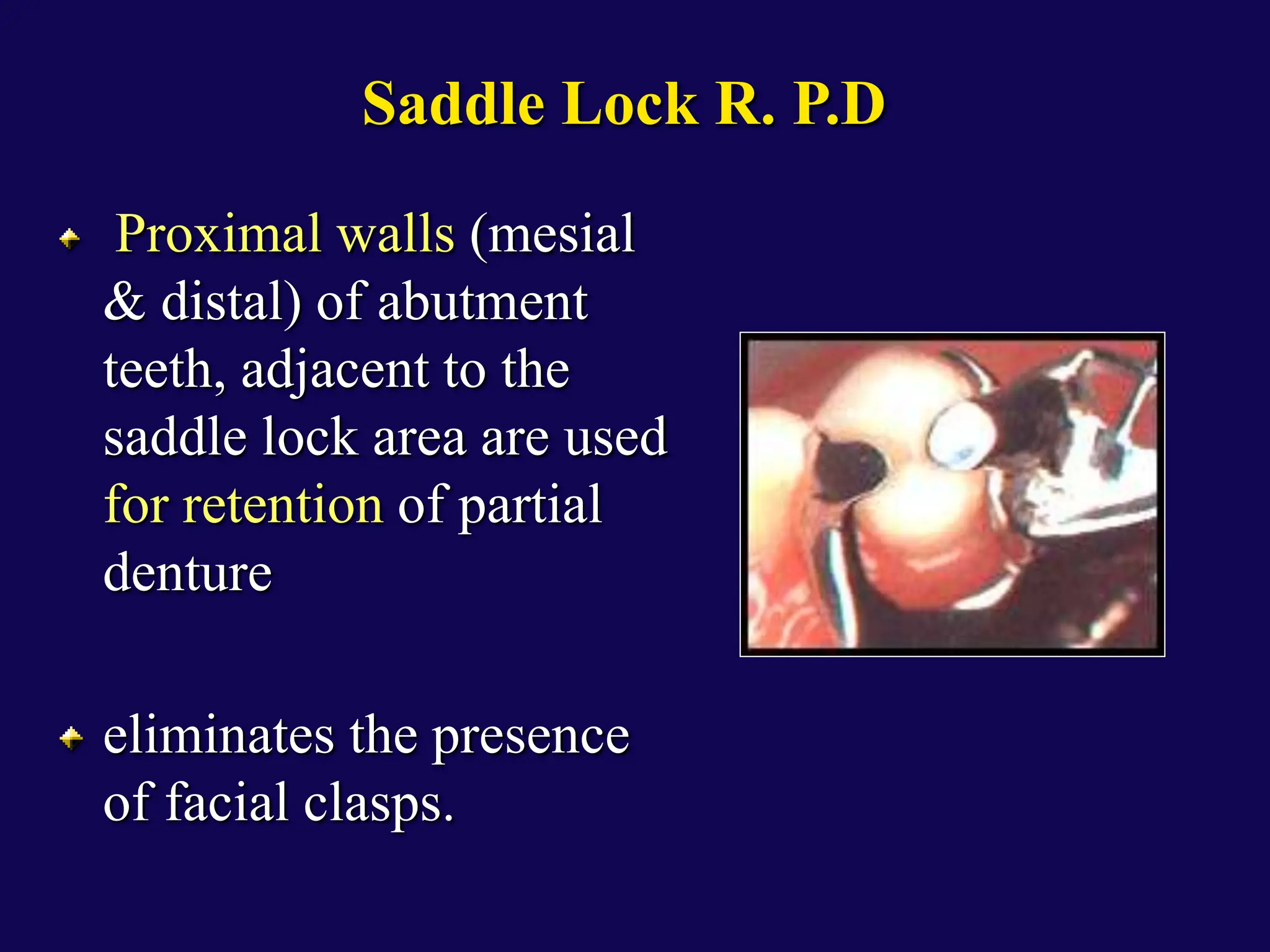 esthetics in RPD.ppt