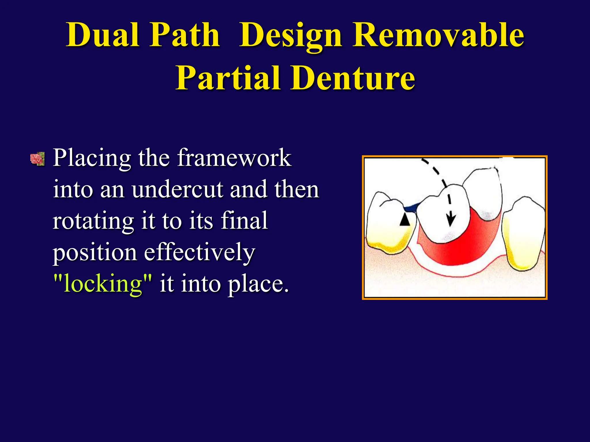 esthetics in RPD.ppt