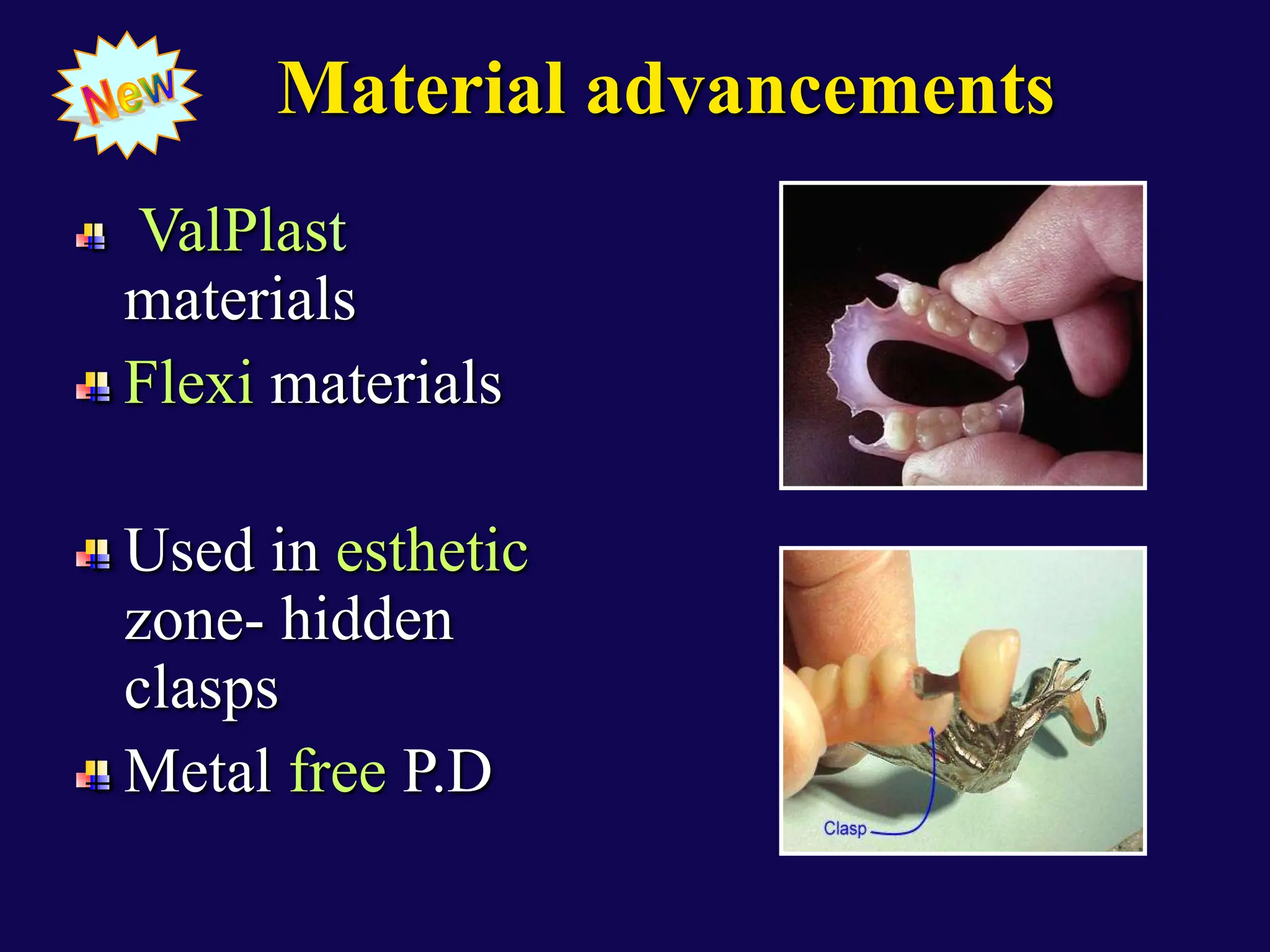 esthetics in RPD.ppt