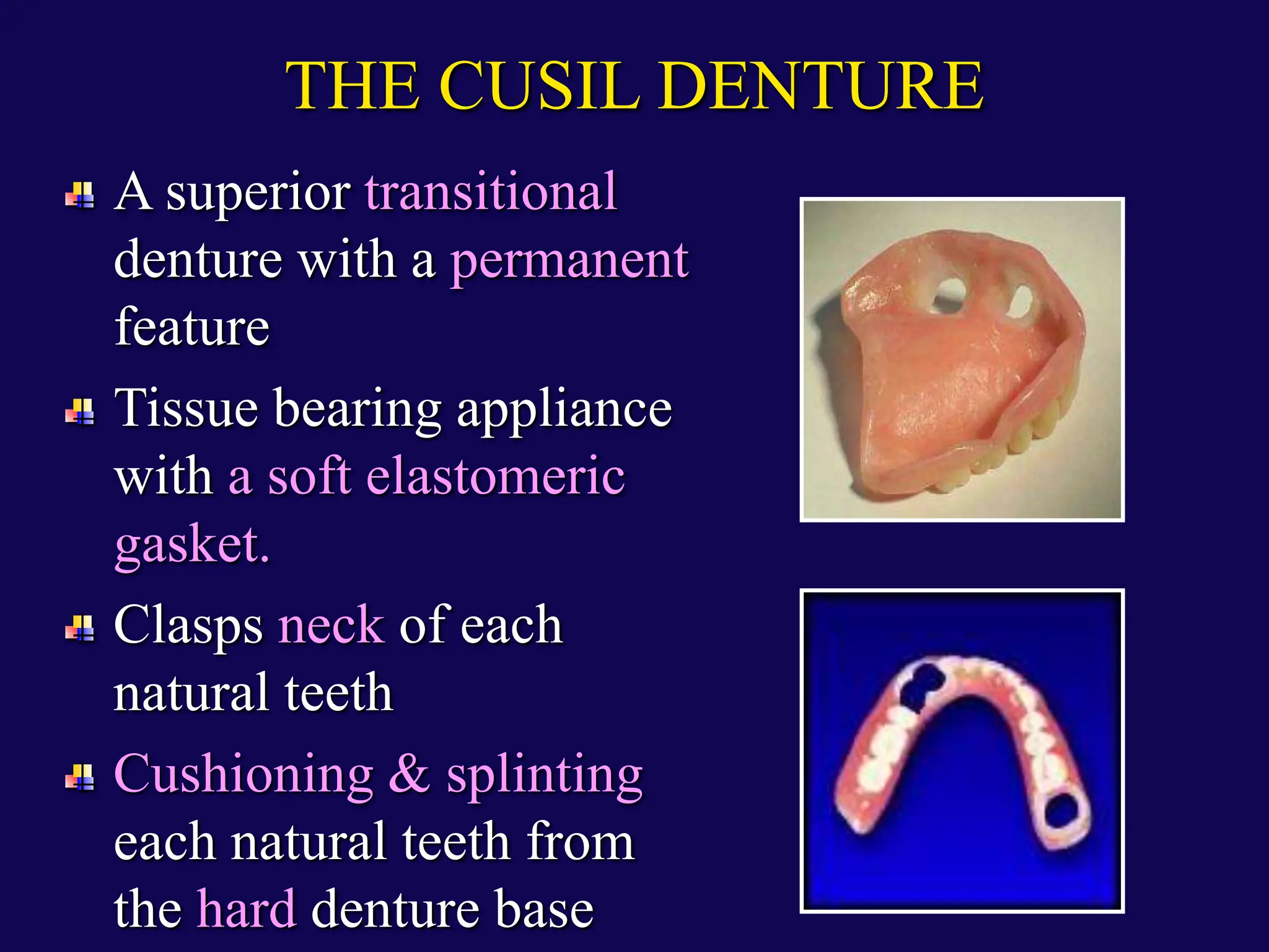 esthetics in RPD.ppt