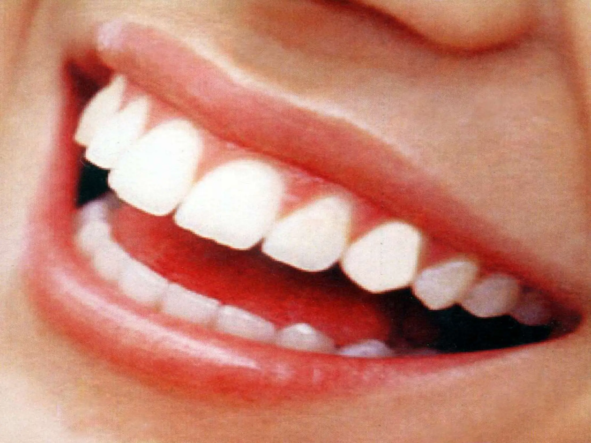 esthetics in RPD.ppt