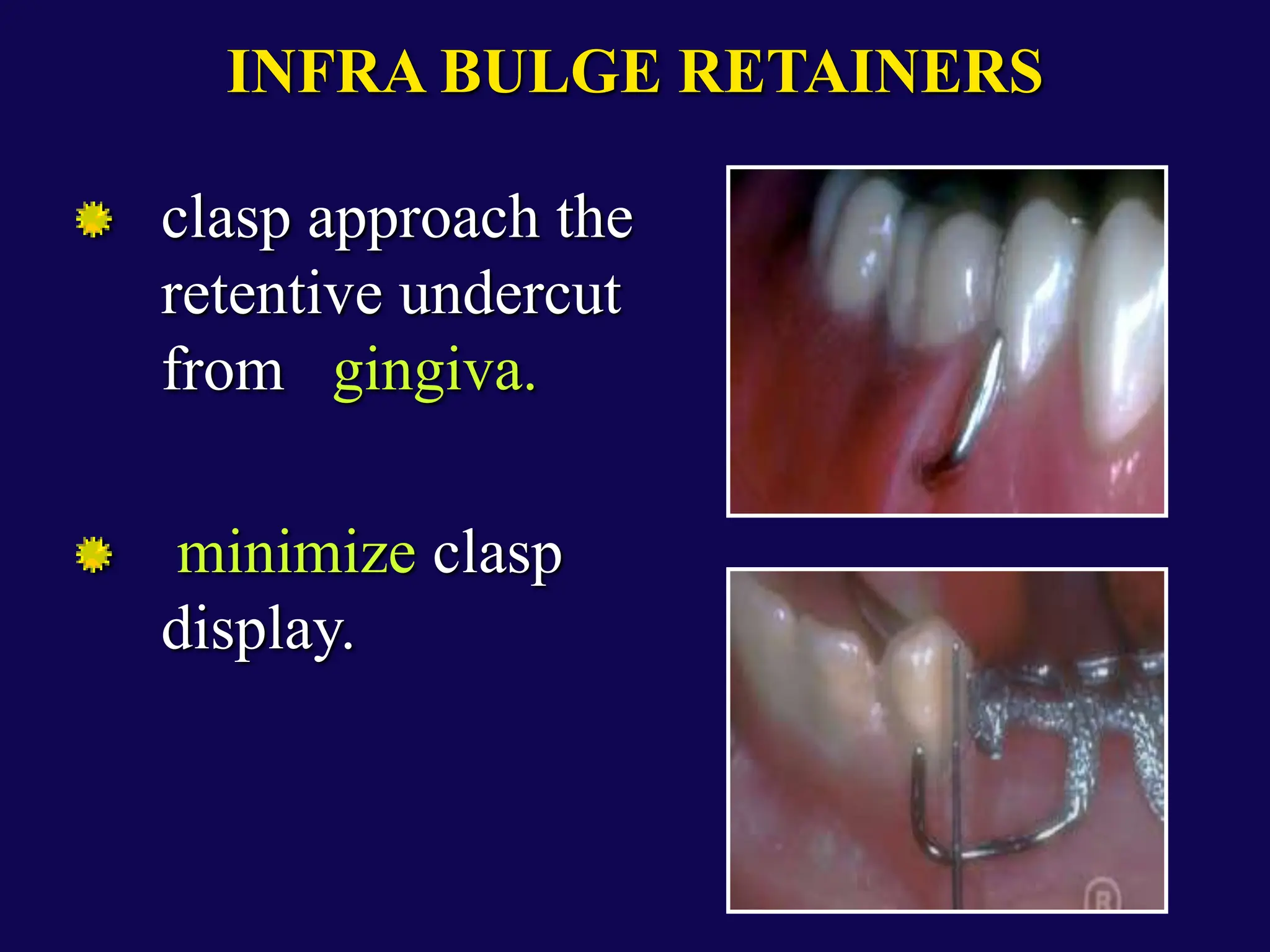 esthetics in RPD.ppt