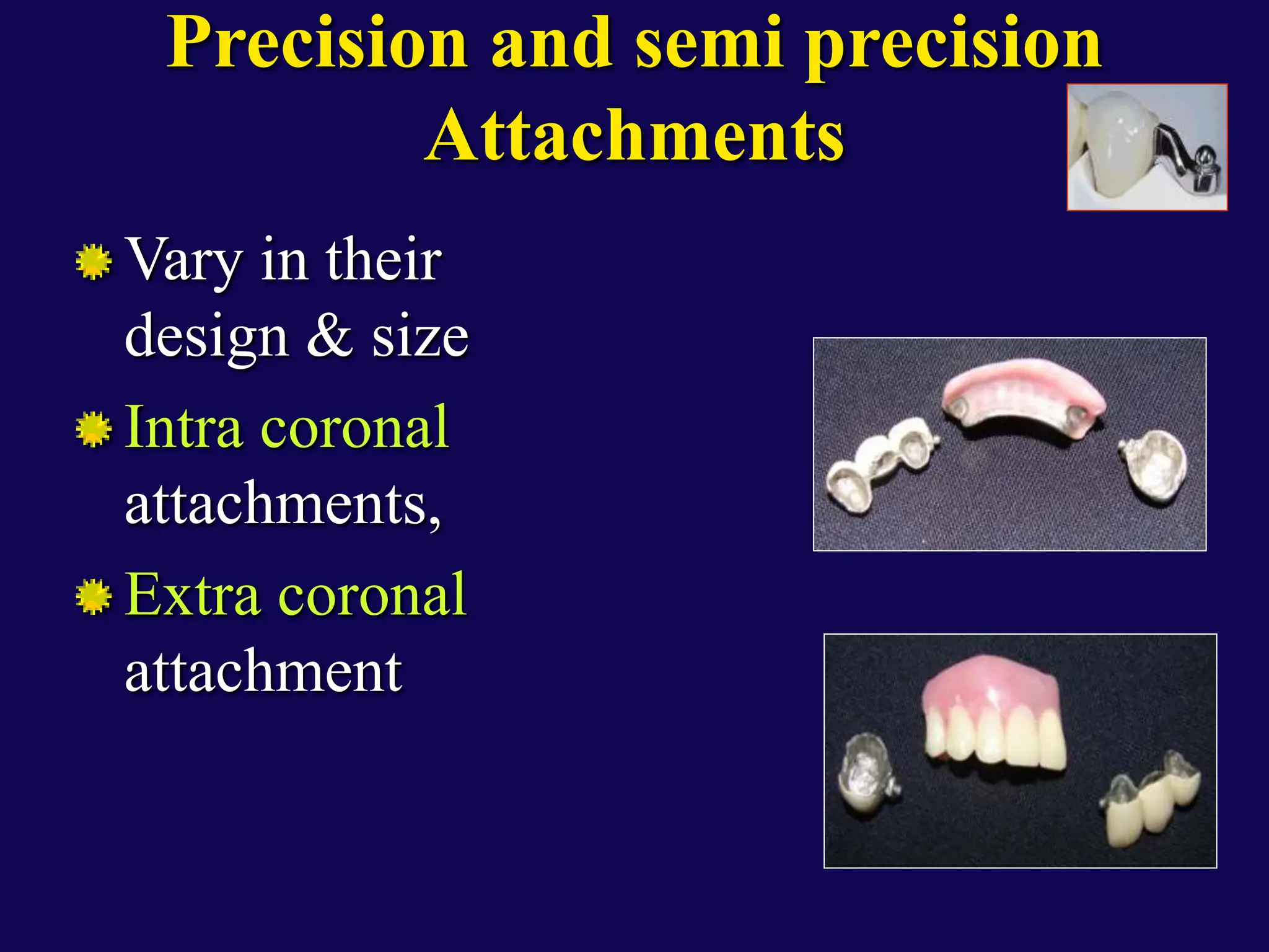 esthetics in RPD.ppt
