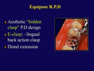 esthetics in RPD.ppt