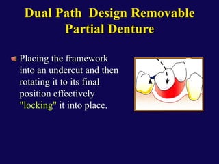 esthetics in RPD.ppt