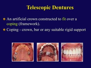 esthetics in RPD.ppt