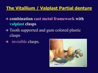 esthetics in RPD.ppt