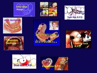 esthetics in RPD.ppt