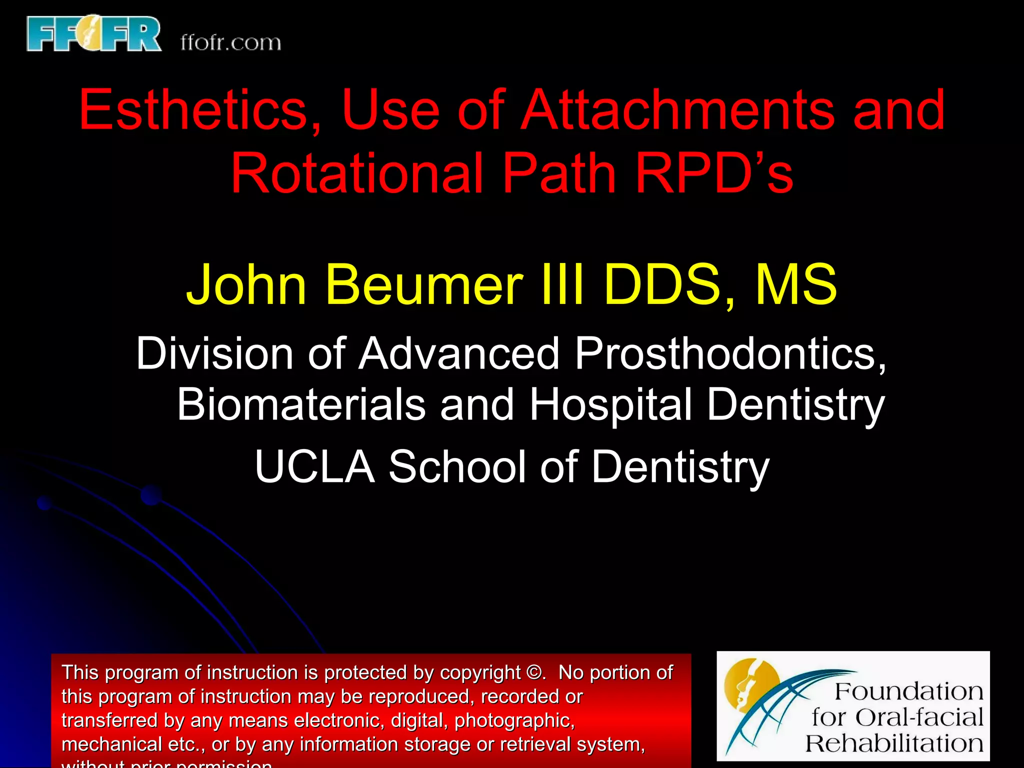 Esthetics, rotational path, attachments | PPT