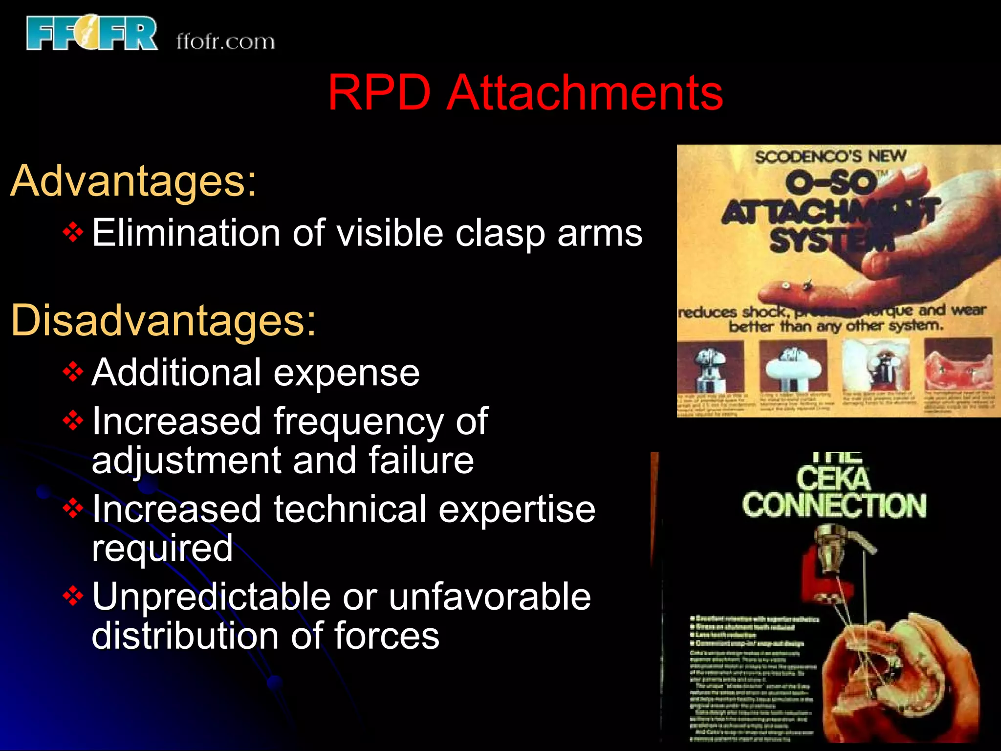 Esthetics, rotational path, attachments | PPT