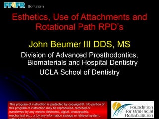 Esthetics, rotational path, attachments | PPT