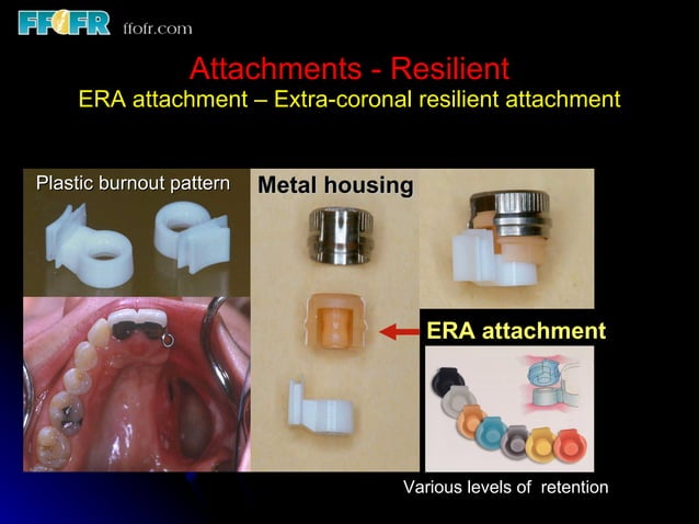 Esthetics, rotational path, attachments | PPT