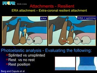 Esthetics, rotational path, attachments | PPT