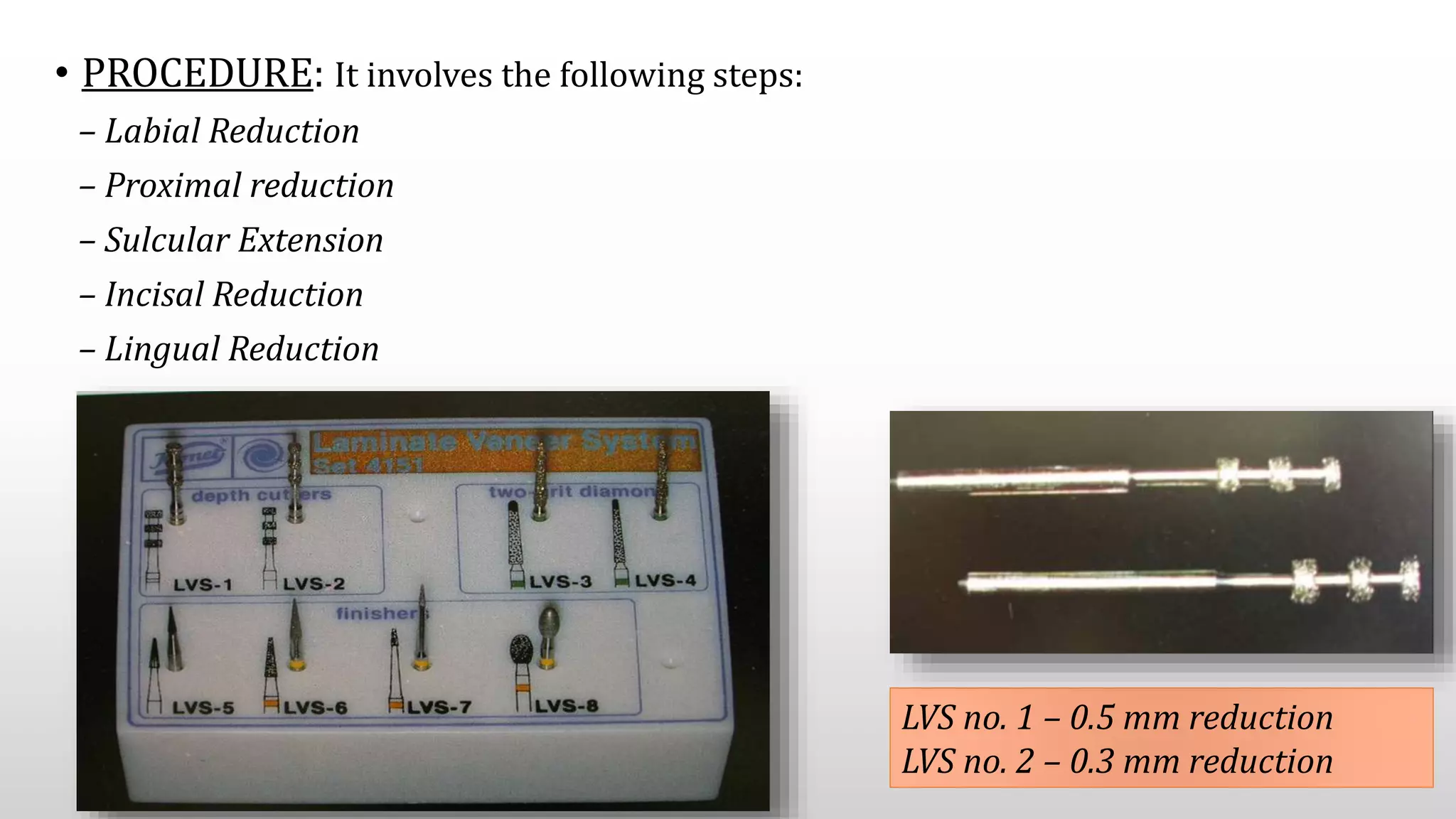 Laminates Veneers in Dentistry | PPTX