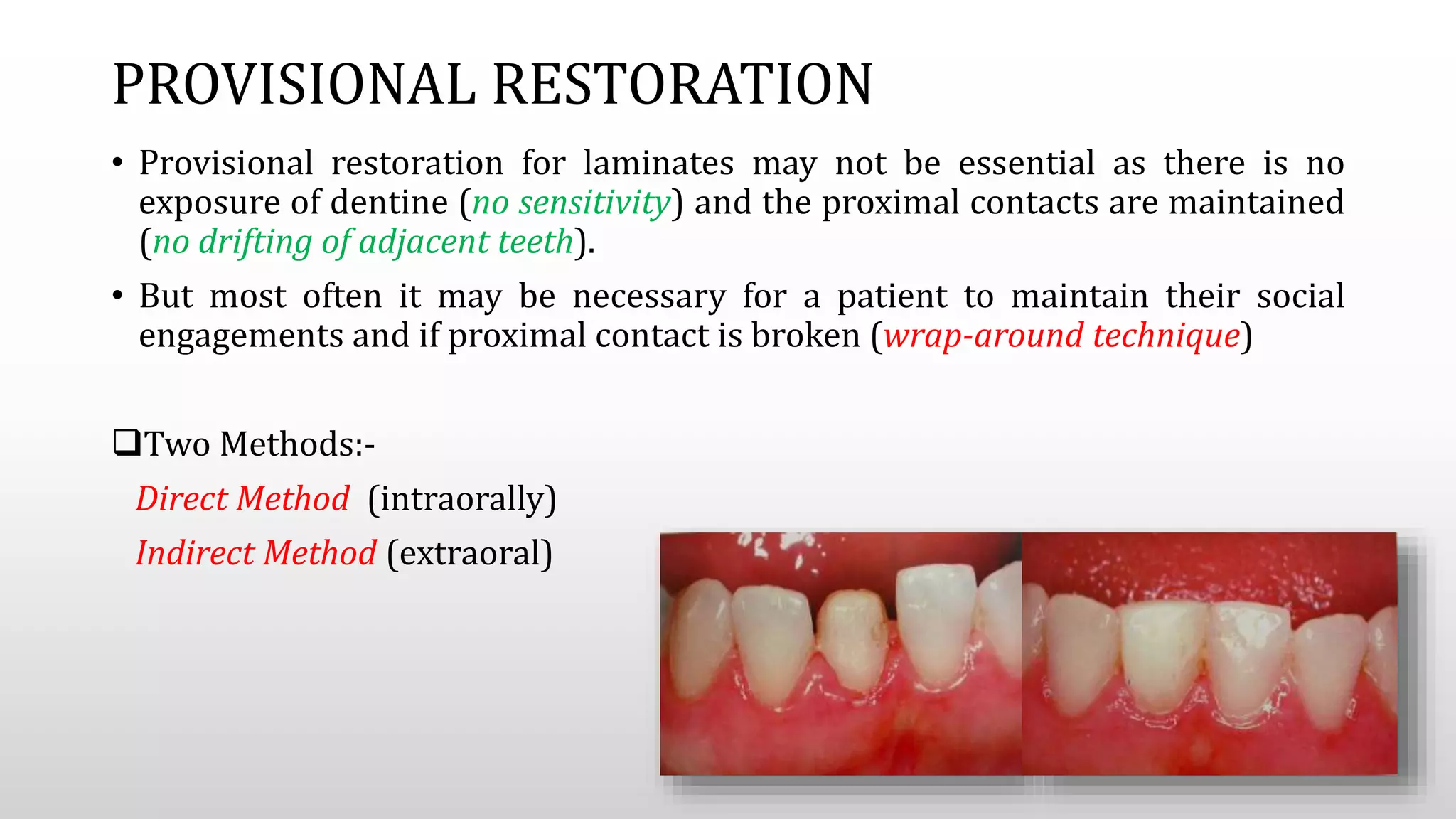 Laminates Veneers in Dentistry | PPTX