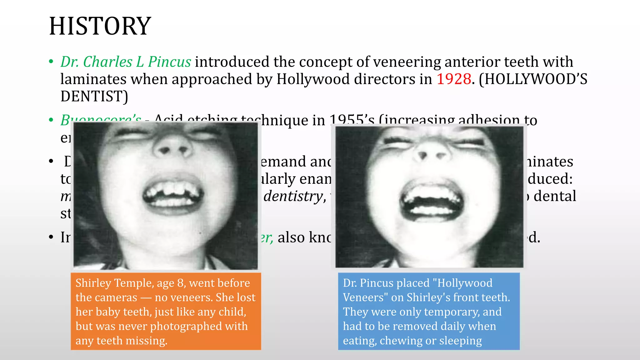 Laminates Veneers in Dentistry | PPTX