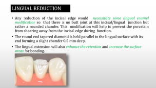 Laminates Veneers in Dentistry | PPTX