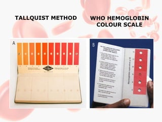 PRESENTATION ON ESTIMATION OF HAEMOGLOBIN | PPTX