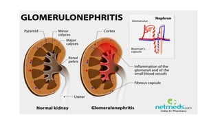 Estimation of blood urea nitrogen/urea.pptx