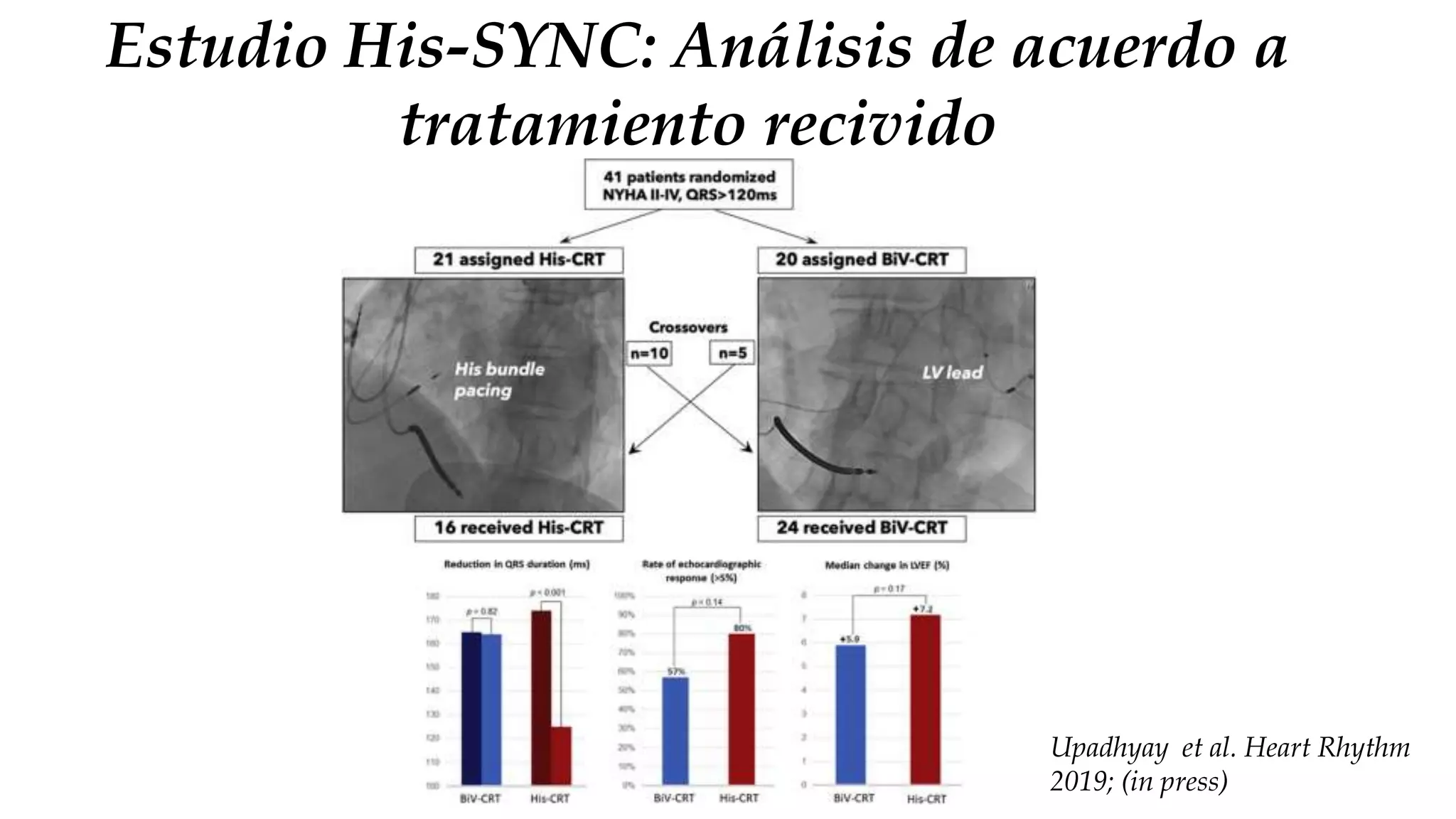 Estimulacion del his como resincronizacion | PPTX