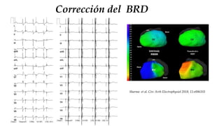 Estimulacion del his como resincronizacion | PPTX