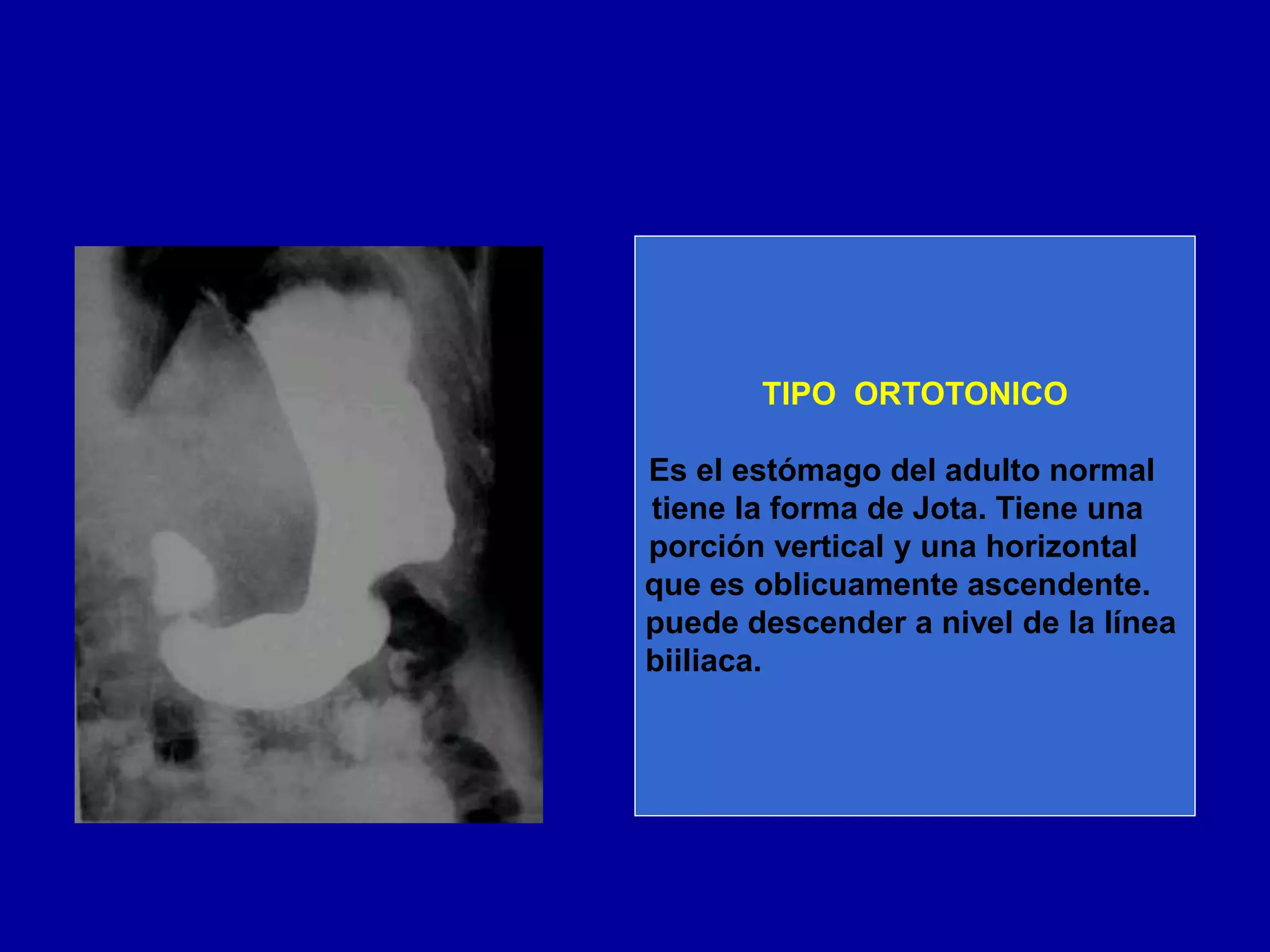 Estomago-Radioaanatomia.ppt