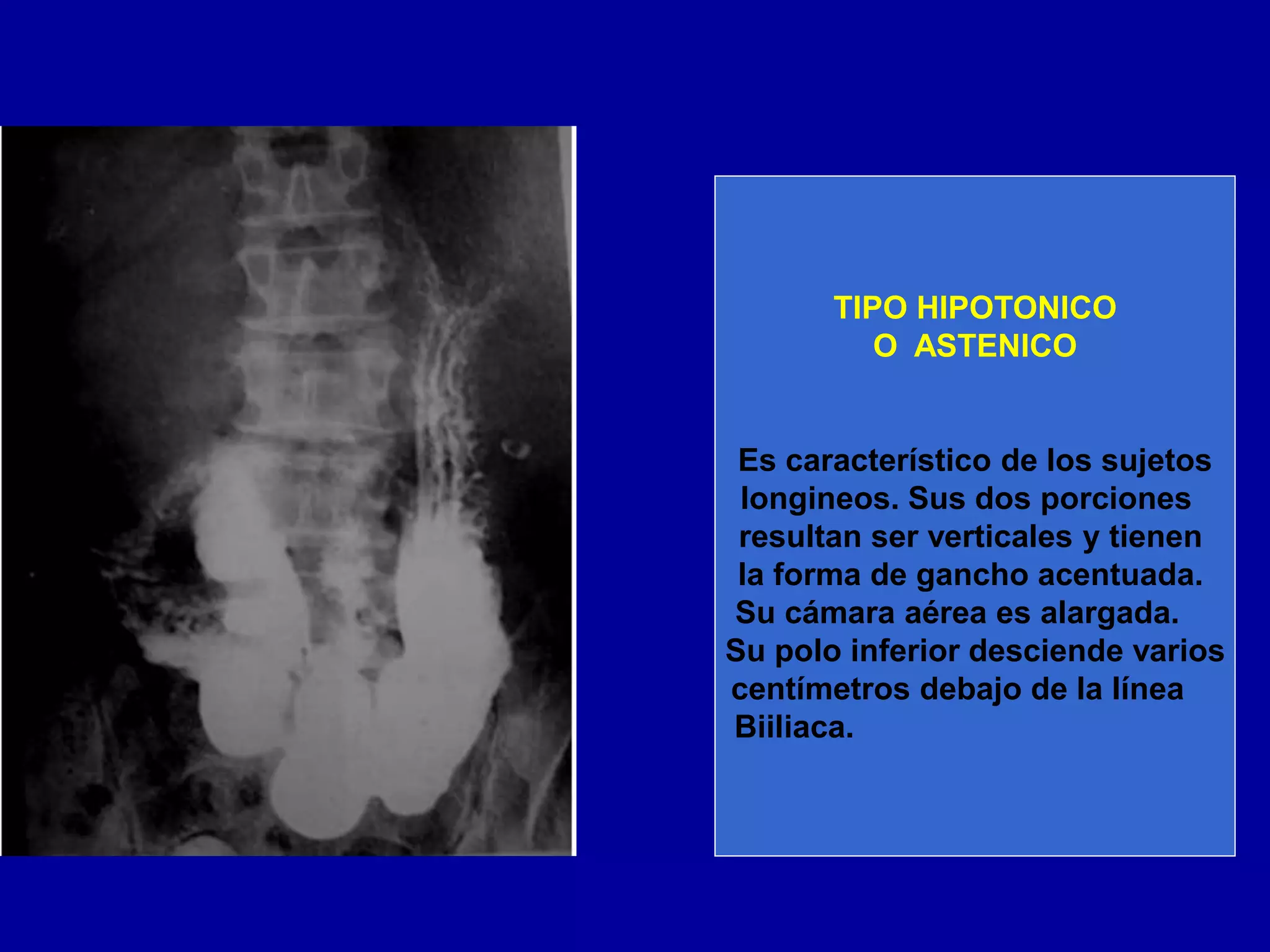 Estomago-Radioaanatomia.ppt