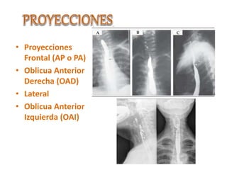 Esofagoestomagoduodeno | PPTX