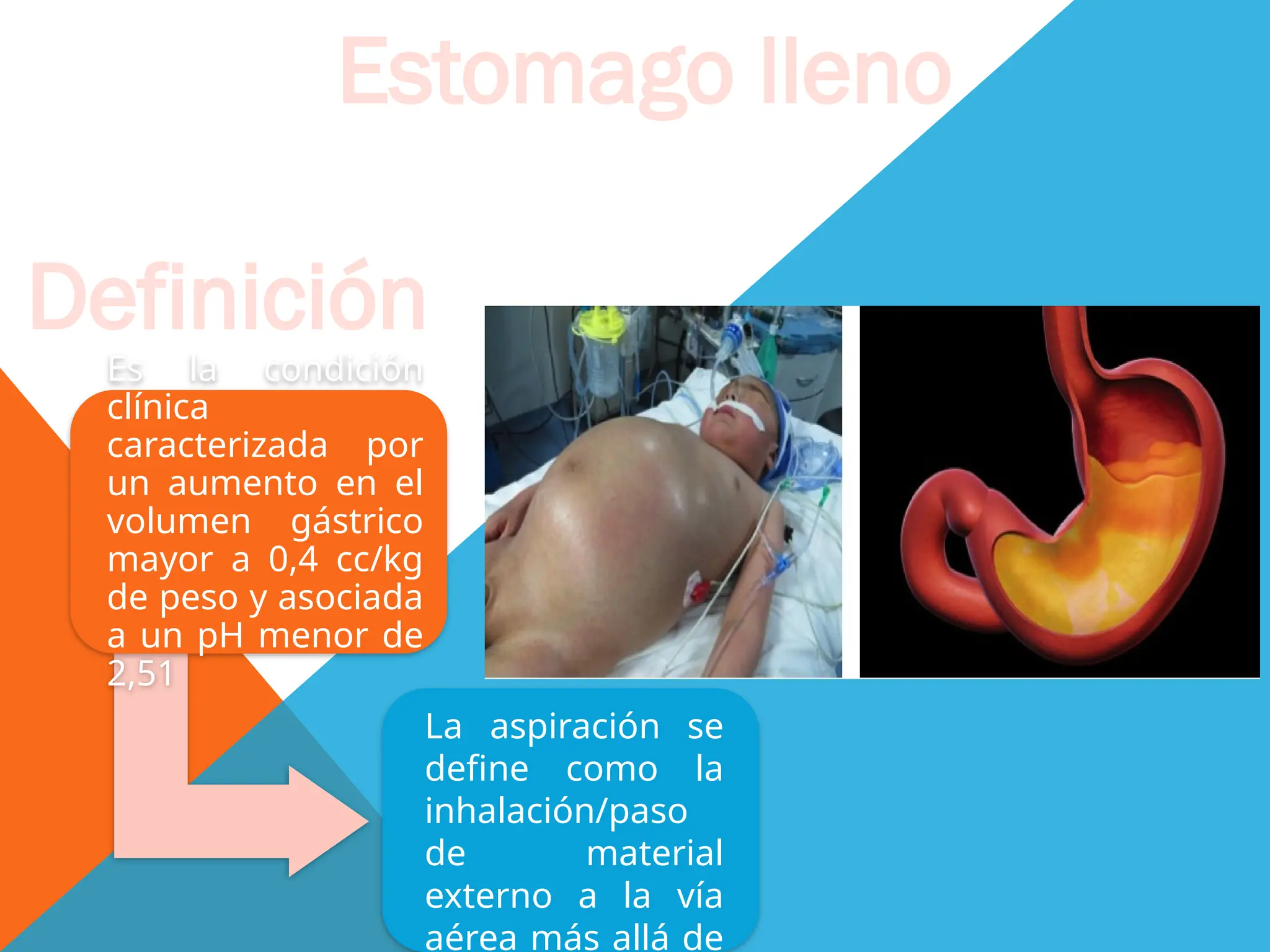 estomago lleno caso clinico.pptmm..mm..x | PPTX