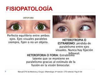 Estrabismo | PPTX